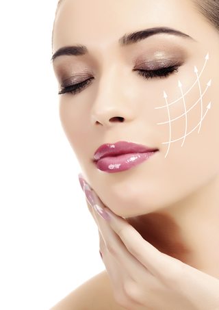 Silhouette Soft Thread Lift